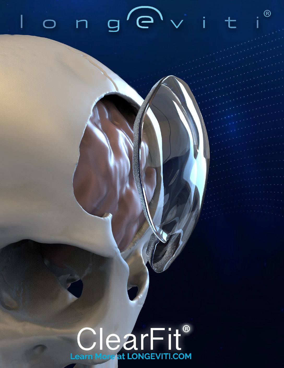 Products: Longeviti Neuro Solutions Medical Devices